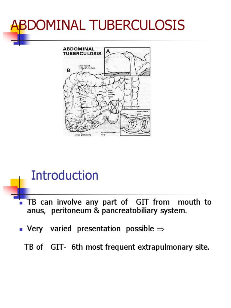Abdominal Tuberculosis | PDF | Tuberculosis | Gastroenterology