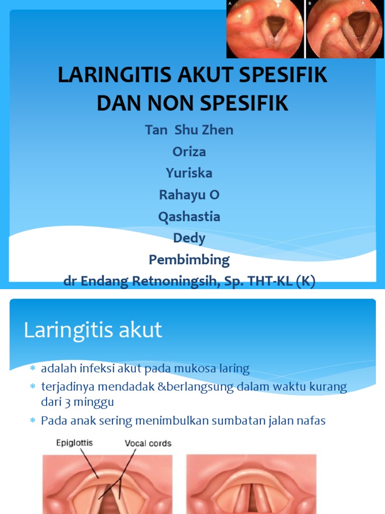 Laringitis Akut Spesifik Dan Non Spesifik | PDF
