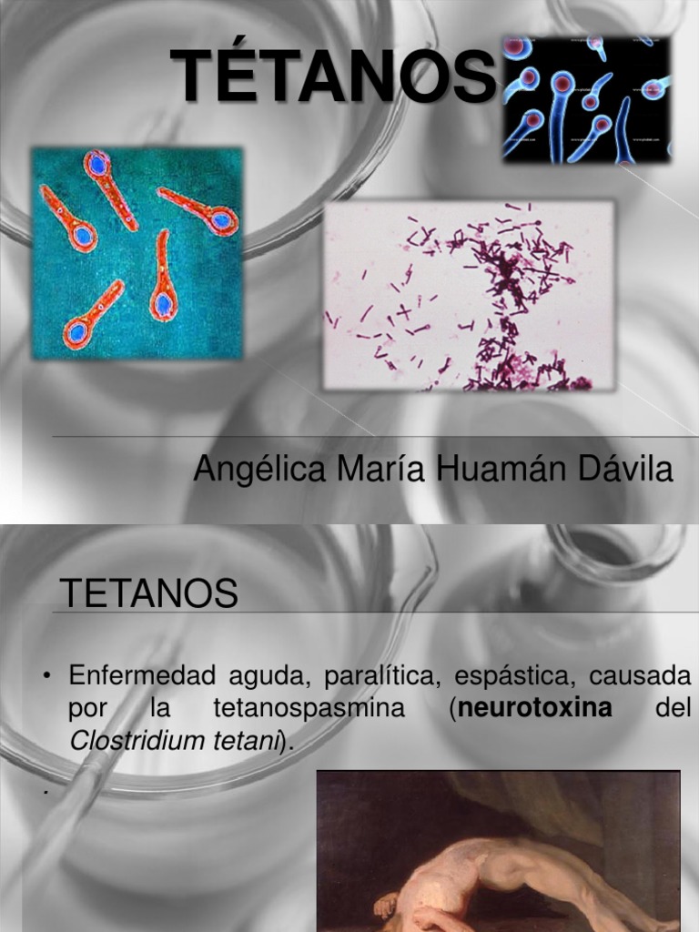 Tétanos: Causas, Síntomas y Tratamiento | PDF | Enfermedades y trastornos | Medicina CLINICA