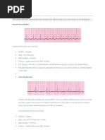 ACLS EKG Rhythms and Interpretation | PDF | Heart | Electrocardiography