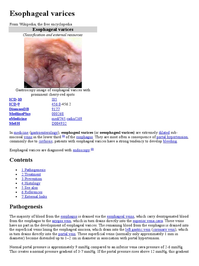 Esophageal Varices | Clinical Medicine | Gastroenterology