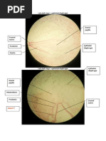 Anatomical Landmarks of The Crown | PDF | Mouth | Dentistry Branches