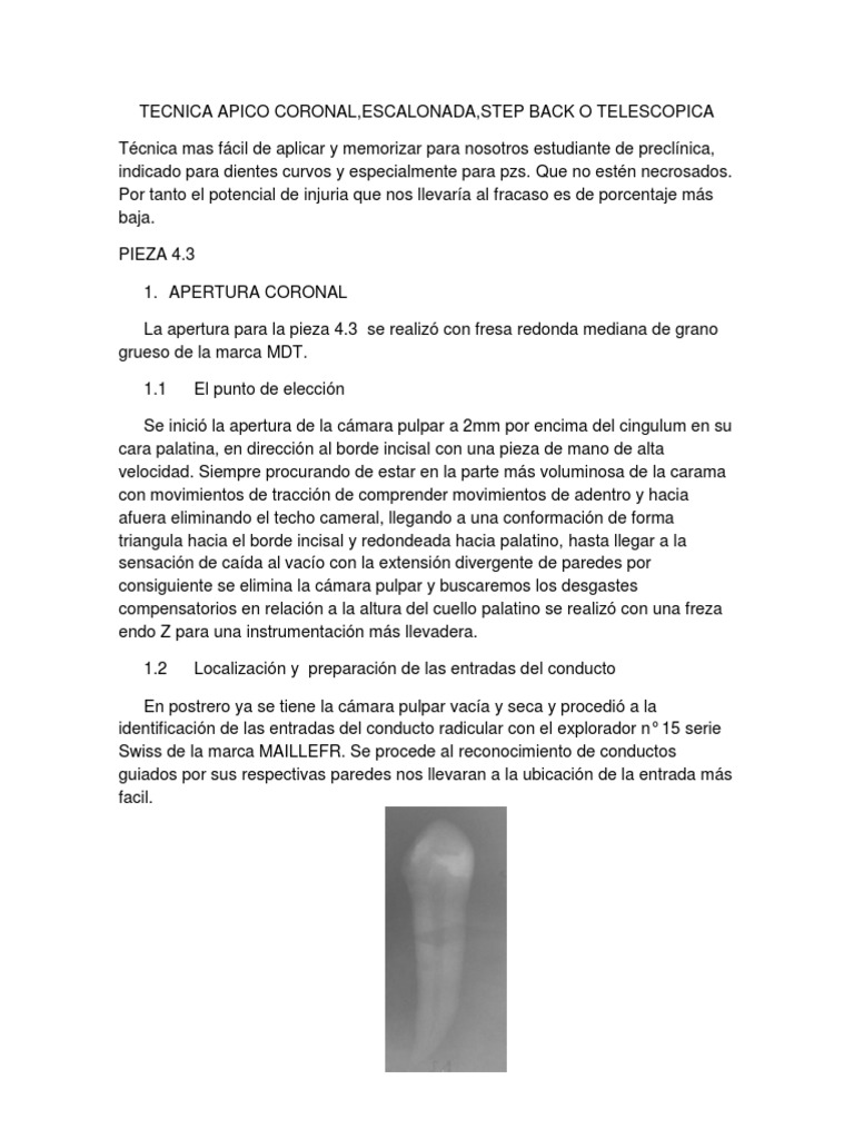Técnica Step Back en Endodoncia | PDF | Calibración | Naturaleza