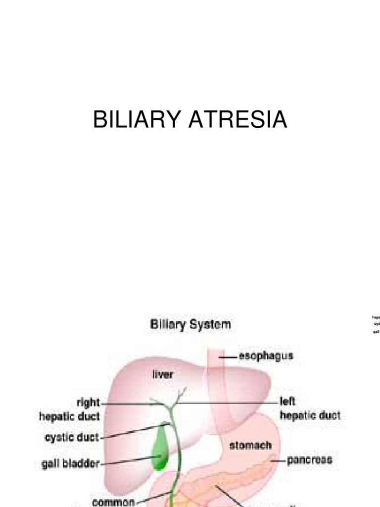 Biliary Atresia Digestive IV | PDF | Liver | Bile