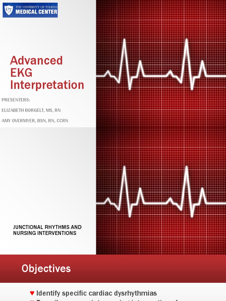 Advanced EKG Refresher | Marcapasos cardíaco artificial | Angina de pecho