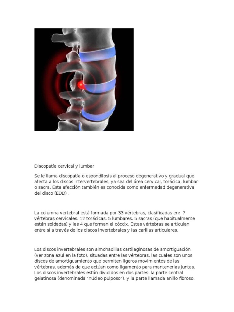 Discopatia | PDF | Vértebra | Sistema esquelético