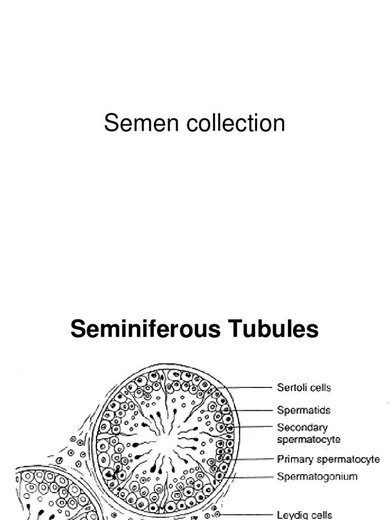 Semen Collection Evaluation And Processing I Pdf Semen Sexual Anatomy 