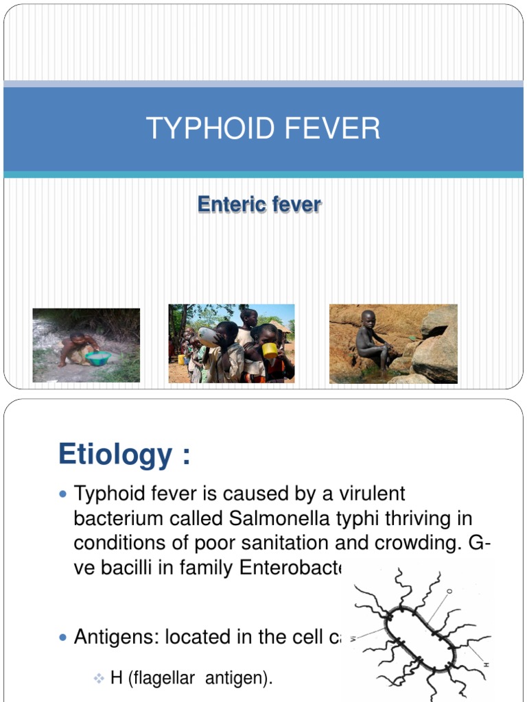 04 - Typhoid Fever | Epidemiology | Medical Specialties