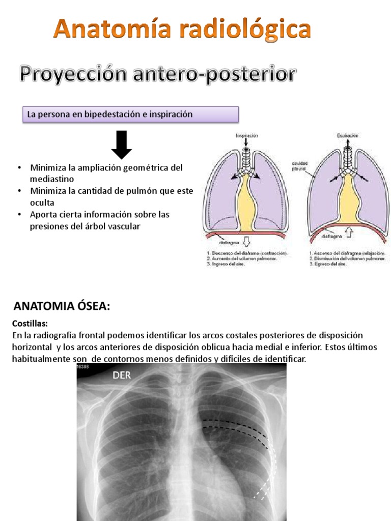 RX de Torax | PDF | Tórax | Pulmón
