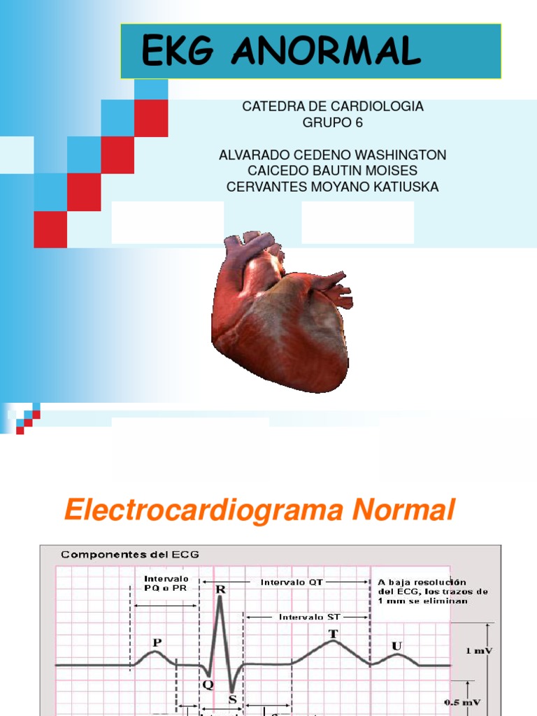 Cardio Ekg Anormal | Electrocardiografia | Arritmia cardiaca | Prueba ...