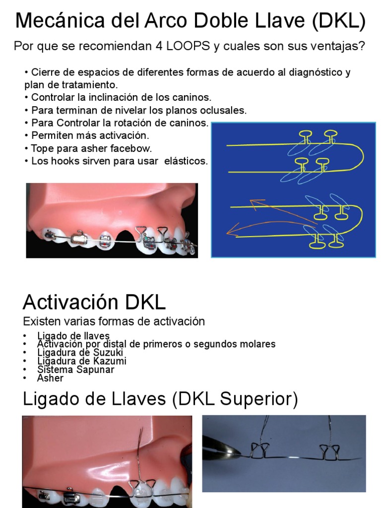DKL ortodoncia | Diente | Anatomía dental