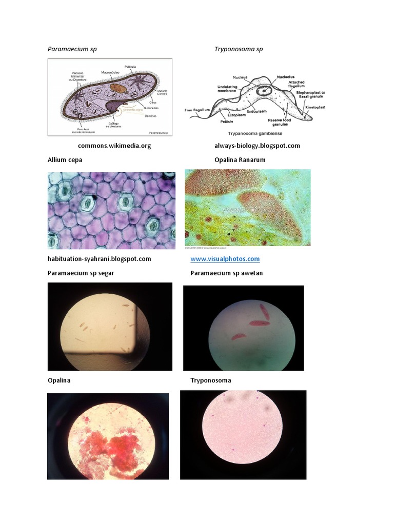 Opalina and Paramaecium Overview | PDF | Home & Garden