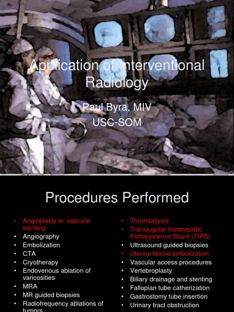 Application of Interventional Radiology | PDF | Angiography | Vein