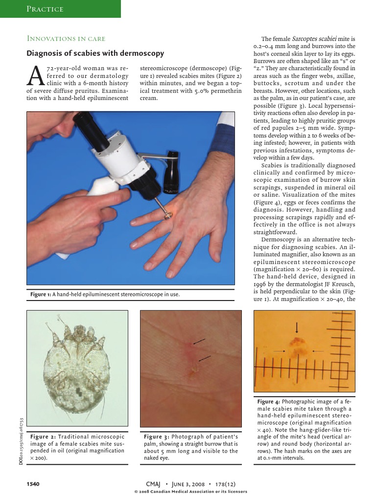 Diagnosis of Scabies With Dermos | PDF | Health Care | Health Sciences