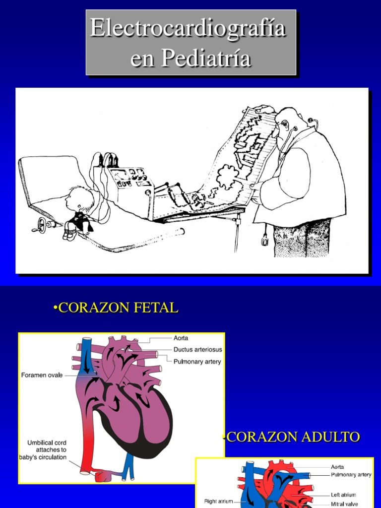 Electrocardiograma en Pediatria | PDF | Electrocardiografia | Corazón