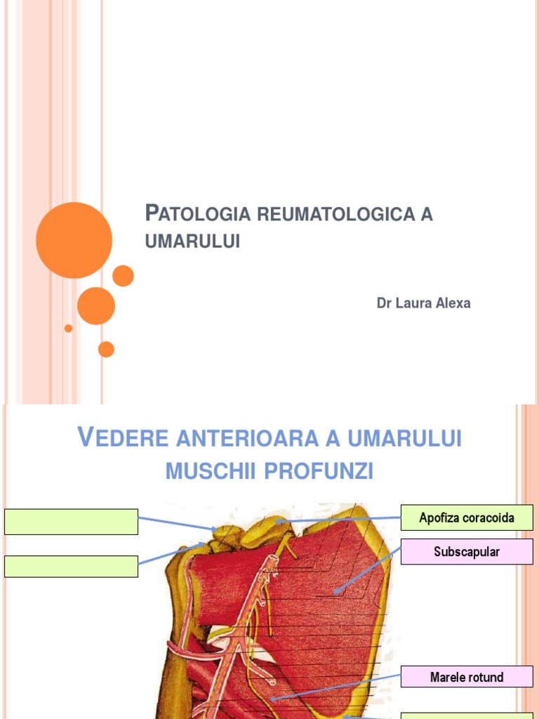 periartrita scapulo-humerala