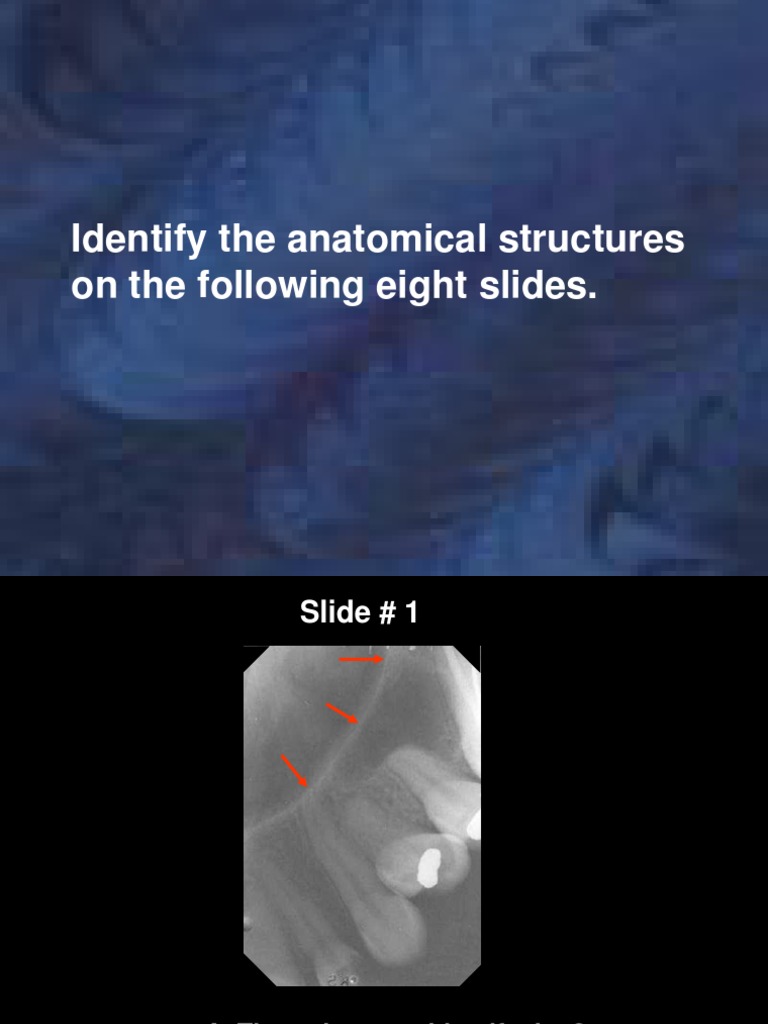Anatomical Structures Identification Guide | PDF
