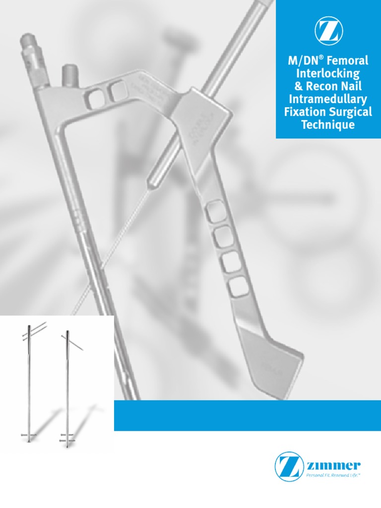 MDN Femoral Interlocking Recon Nail Intramedullary Fixation Metal Guide ...