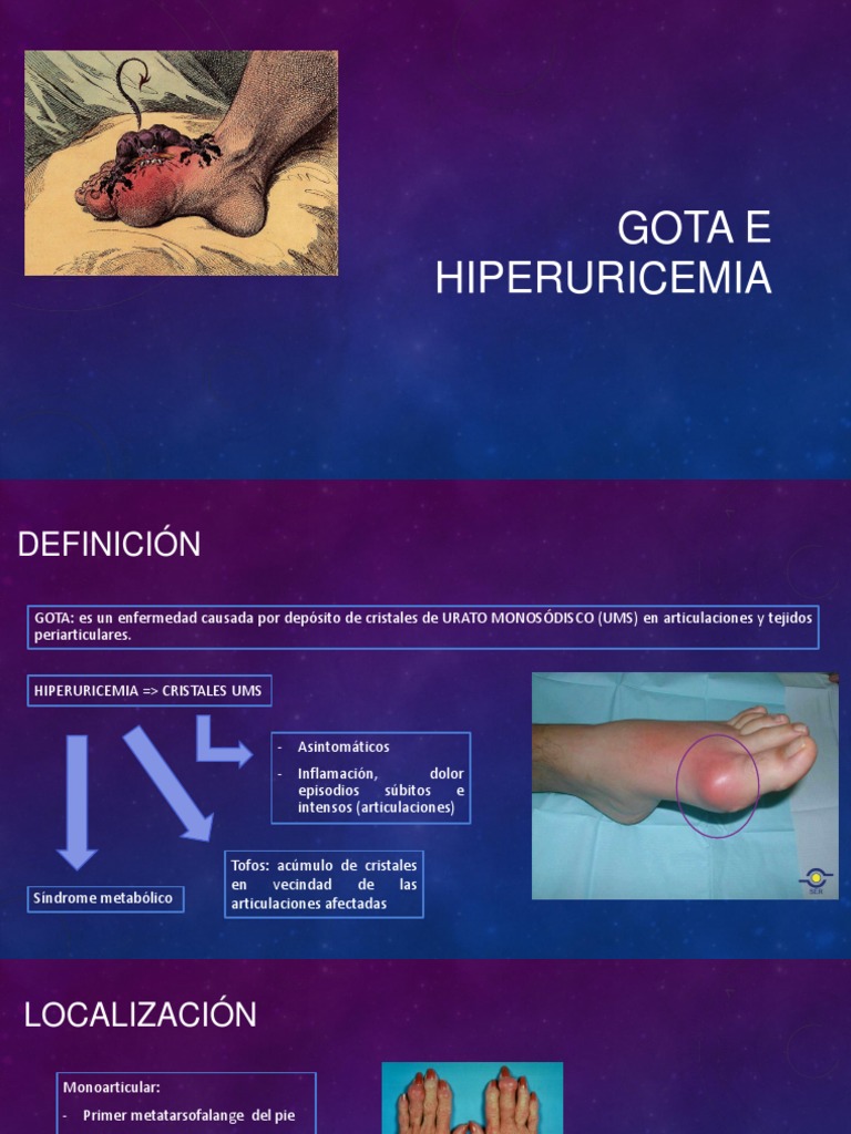 Gota E Hiperuricemia