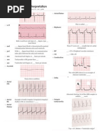 ECG EKG Examples and Quiz | PDF | Electrocardiography | Cardiac ...