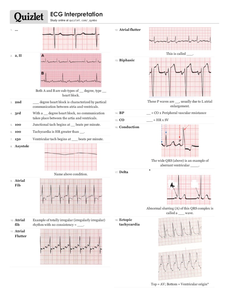 ECG Interpretation | PDF | Electrocardiography | Heart