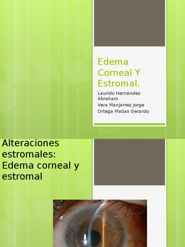 Edema Corneal Y Estromal | PDF | Córnea | Edema