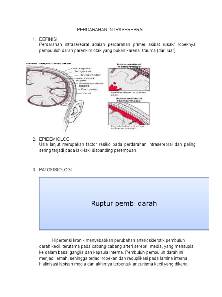 Perdarahan Intraserebral | PDF