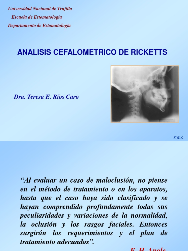 Cefalometria de Rickets 2013-1 PDF | PDF | Anatomía de los primates ...