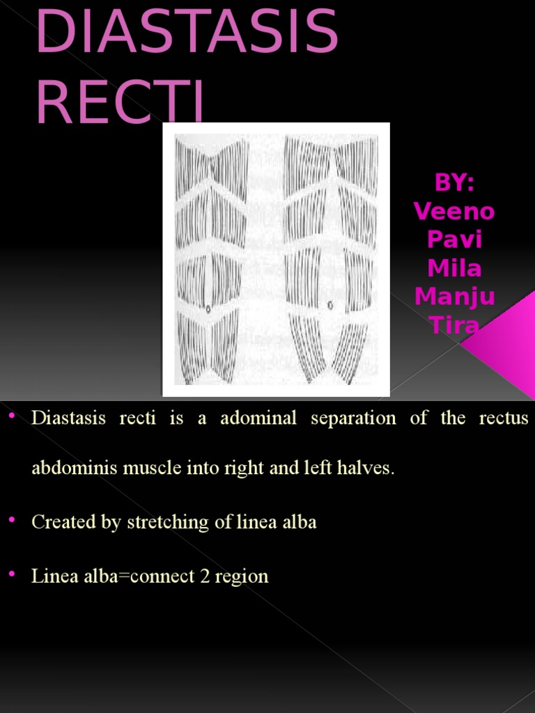 Diastasis Recti | PDF | Abdomen | Human Anatomy