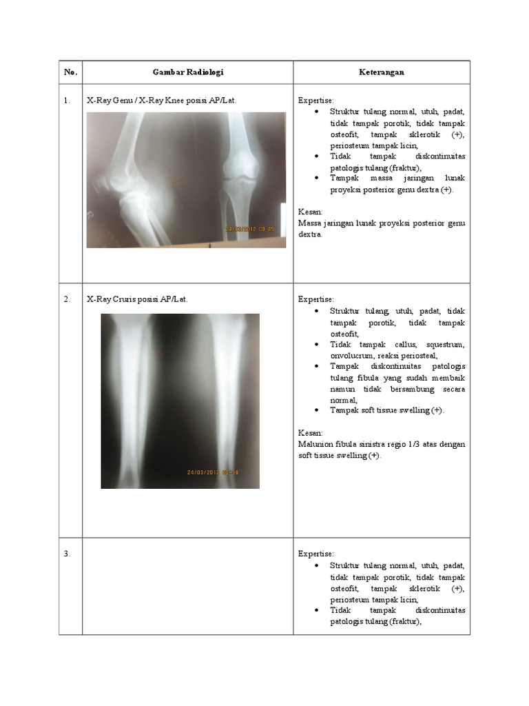 Radiologi Expertise Tulang | PDF