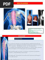 Test de Adams | PDF | Escoliosis | Especialidades Medicas