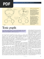 Confrontation Visual Fields - A Guide For Ophthalmologists in Training ...