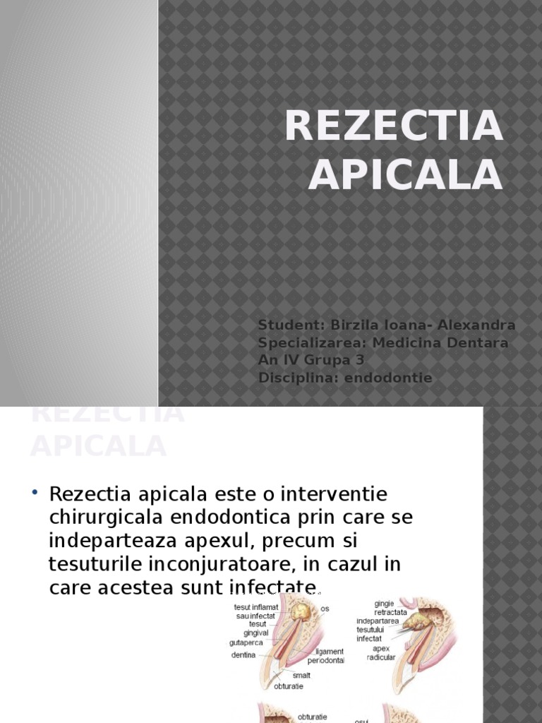 Birzila Ioana - Grupa 3 - Rezectia Apicala - Endo | PDF