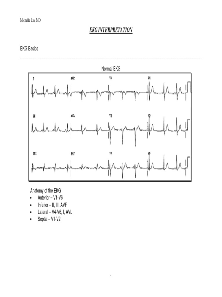 membaca ekg untuk pemula | Electrocardiography | Electrophysiology