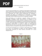 Piramide de Socransky | PDF | Las bacterias | Inmunología