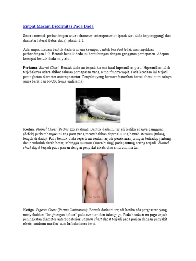 Empat Macam Deformitas Pada Dada | PDF | Kesehatan Holistik | Sains & Matematika