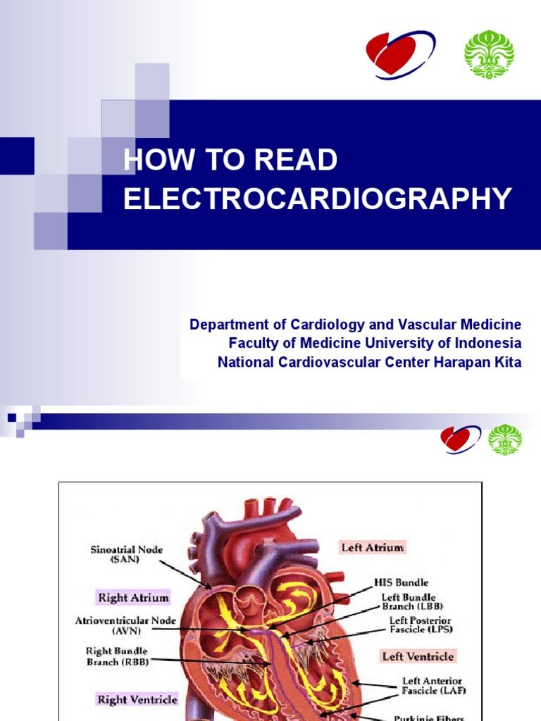 ECG Interpretation | PDF | Electrocardiography | Cardiac Arrhythmia