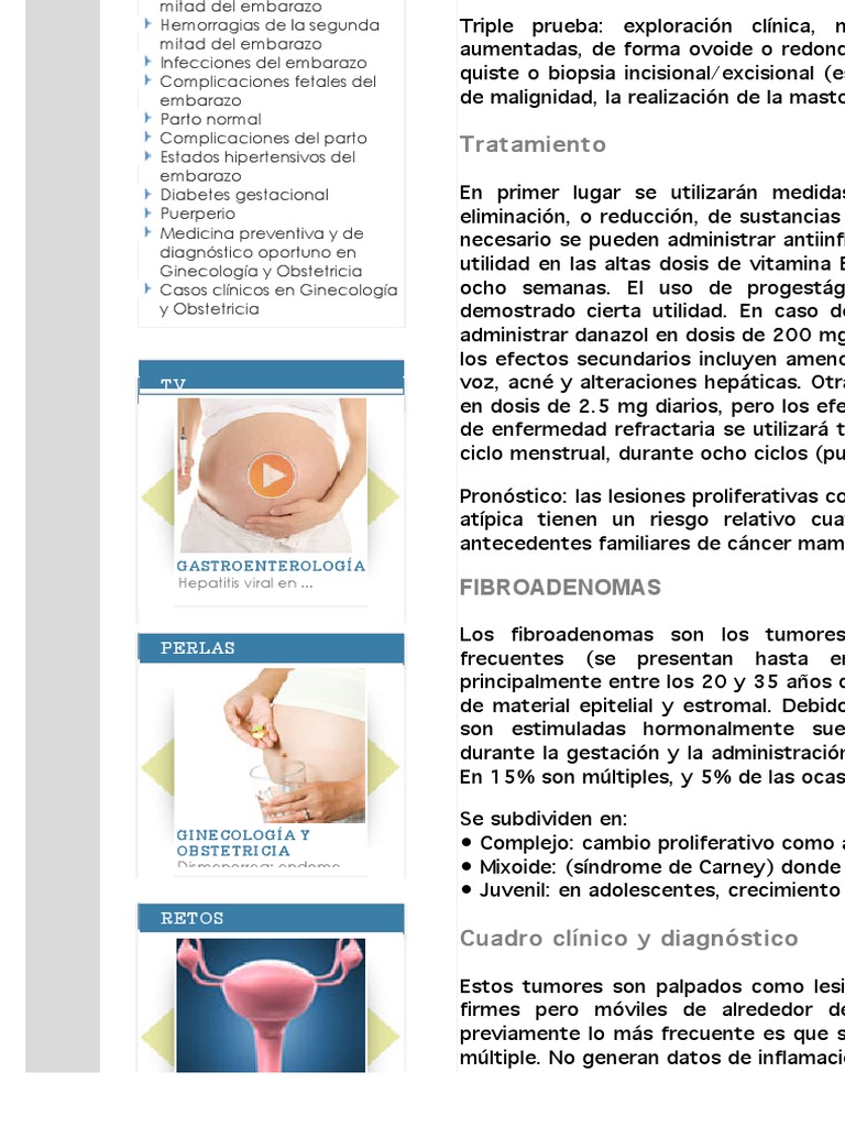 Mastopatia Fibroquistica | PDF | Cáncer | Biopsia