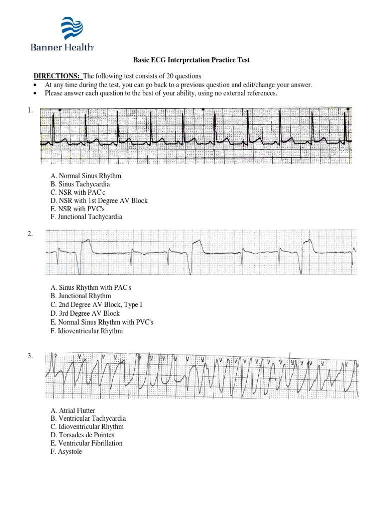 Basic Ecg Interpretation Practice Test V 1 | PDF | Electrocardiography ...