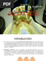 Linea de Fulcrum | PDF