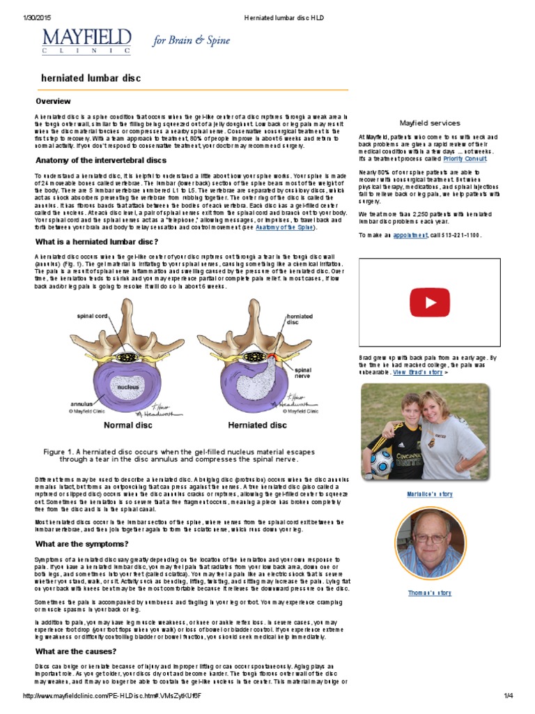 Herniated Lumbar Disc HLD | PDF | Vertebral Column | Musculoskeletal System