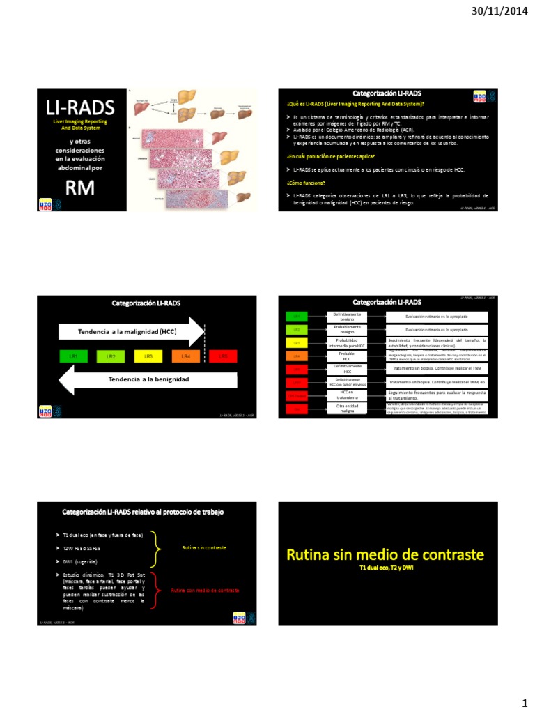 Evaluación Hepática con LI-RADS y RM | PDF | Hígado | Biopsia
