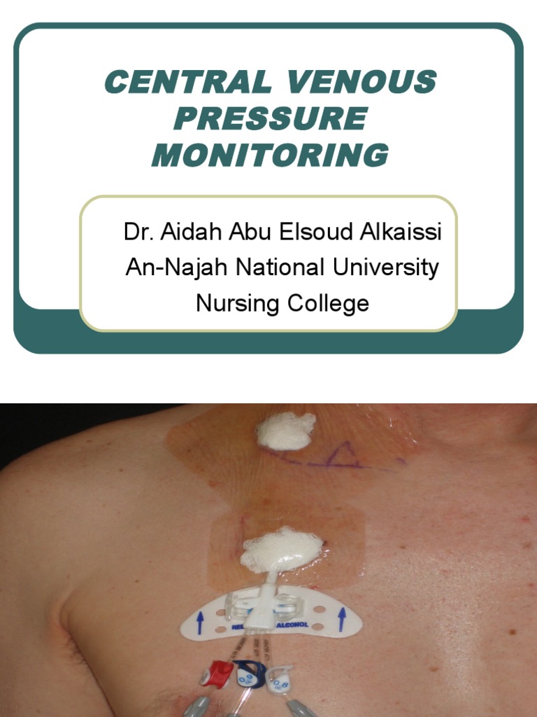 Central Venous Pressure Monitoring Guide | PDF | Intravenous Therapy | Vein