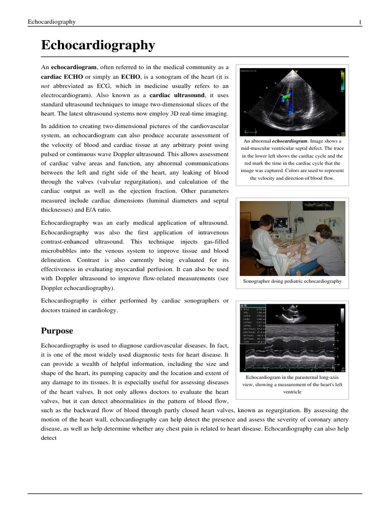 Echocardiography.pdf | Echocardiography | Medical Ultrasound