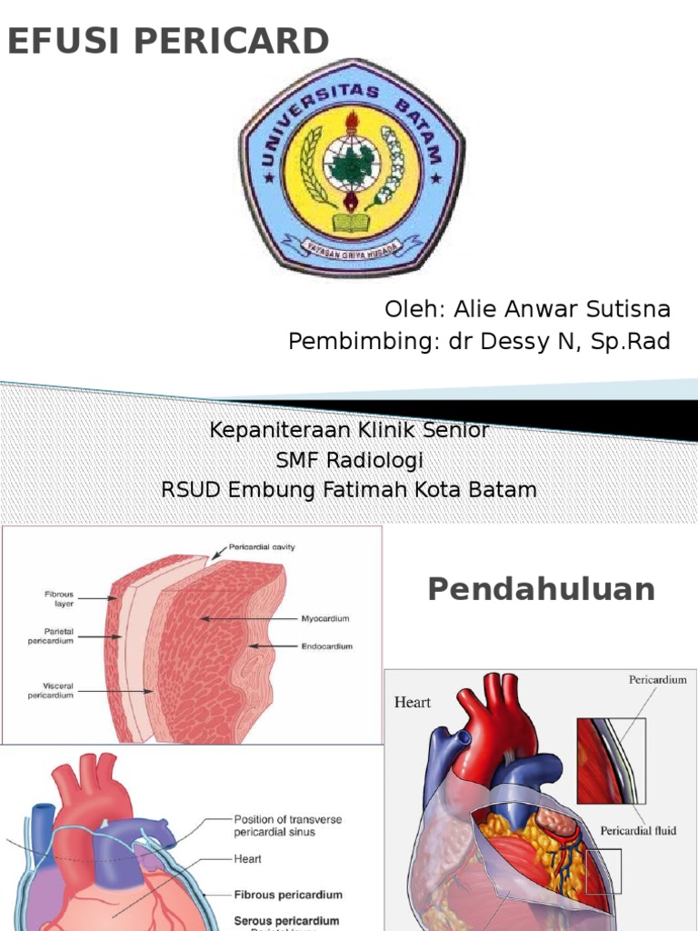 Efusi Pericard | PDF