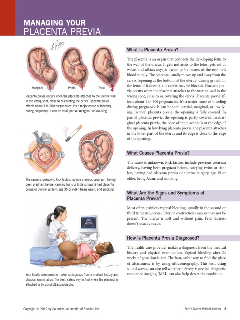 Placenta Previa | PDF | Uterus | Placenta