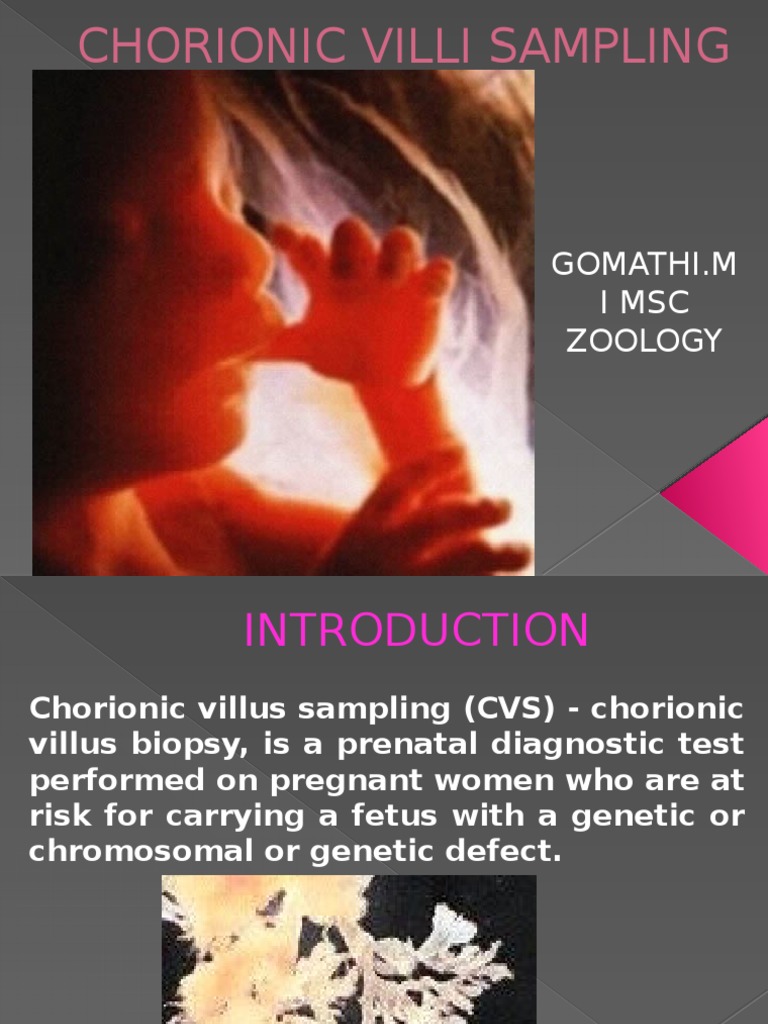Chorionic Villi Sampling | Placenta | Fetus