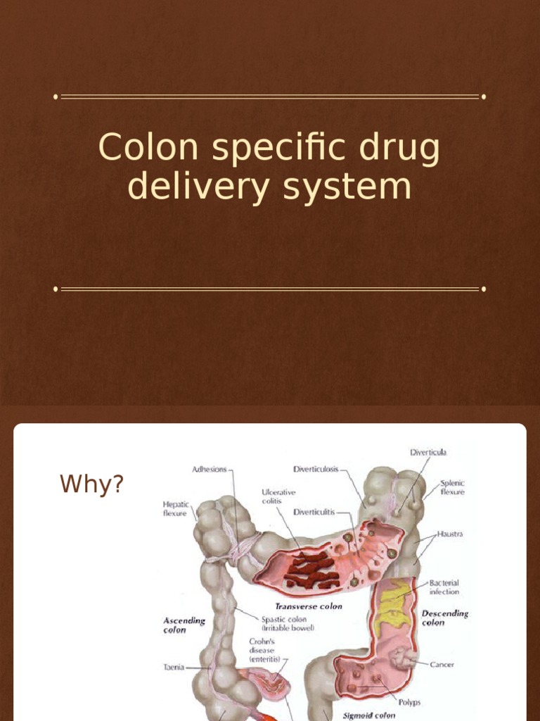 Colon Targeting DDS - ND | PDF | Large Intestine | Gastrointestinal Tract