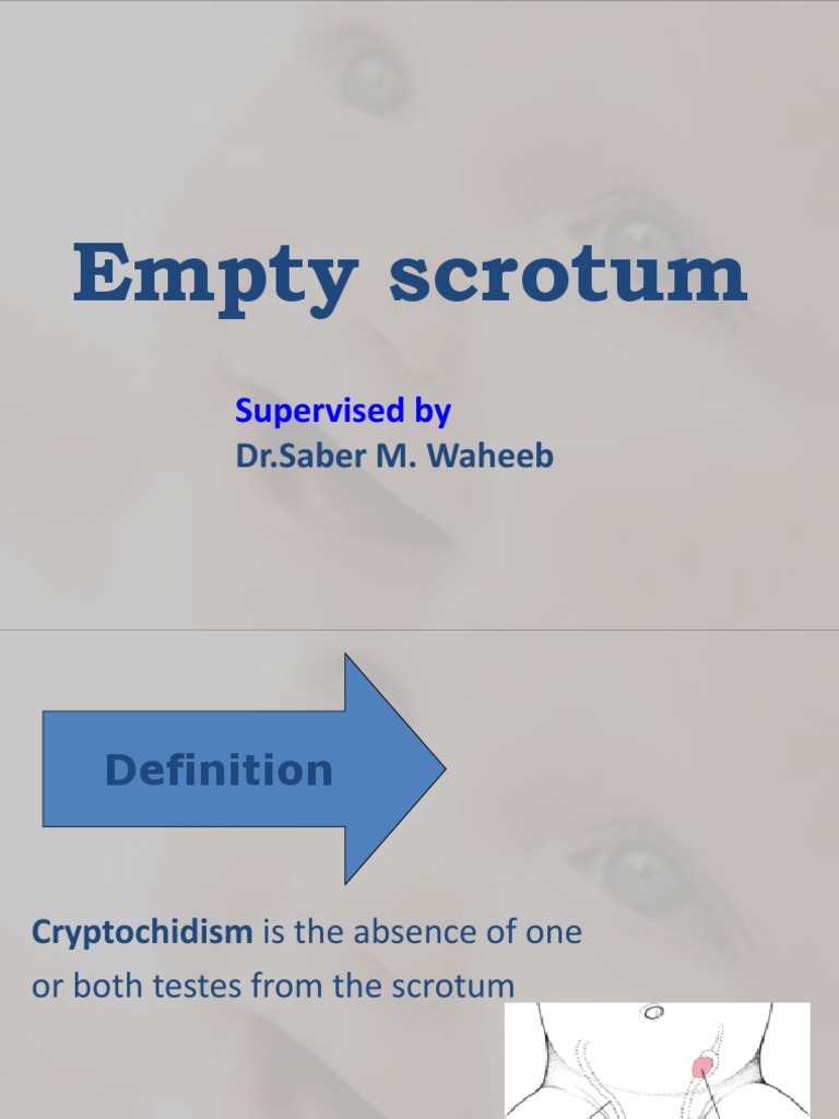 Empty Scrotum | PDF