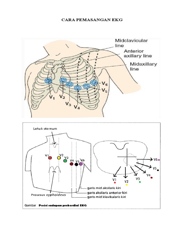 Cara Pemasangan Ekg | PDF